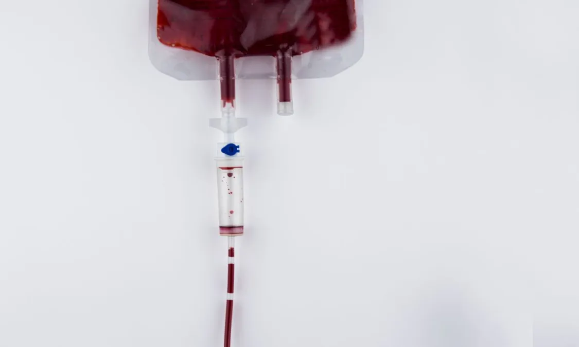 UFBa faz campanha de doação de sangue para animais; confira