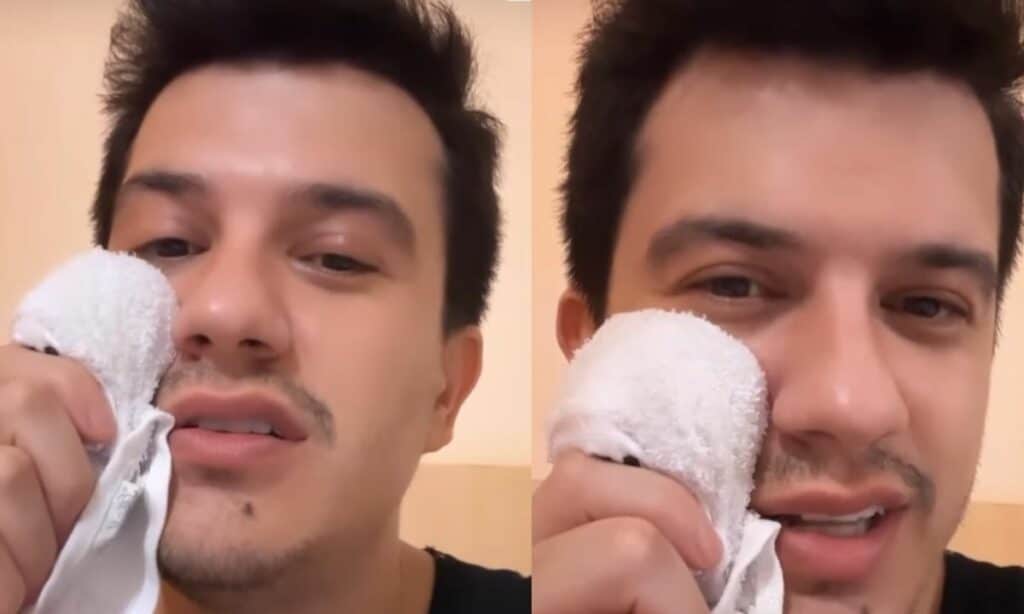 Hugo, da dupla com Guilherme, surge com rosto cortado após fã jogar ...